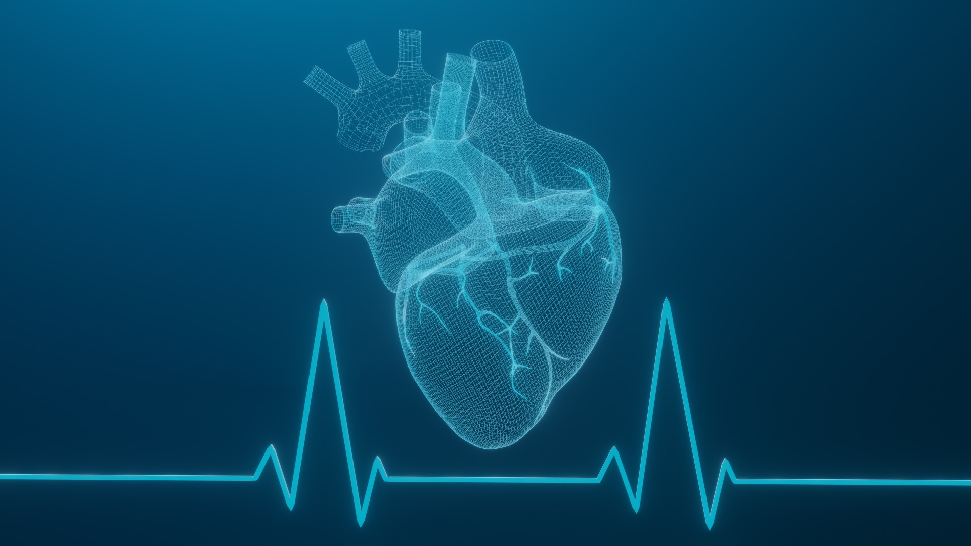 Στεφανιογραφία: Πότε και πώς γίνεται; - Health4u